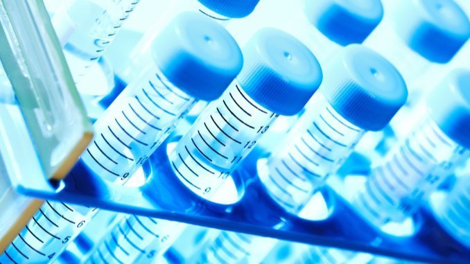 Our Review Of HireRight Drug Test Process